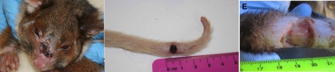 Buruli ulcer in Australia - Buruli ulcer